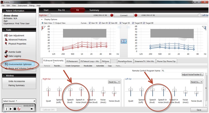 EO2 – The Official ReSound Blog